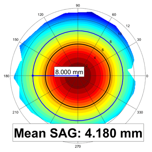 Science of sMap3D - Visionary Optics
