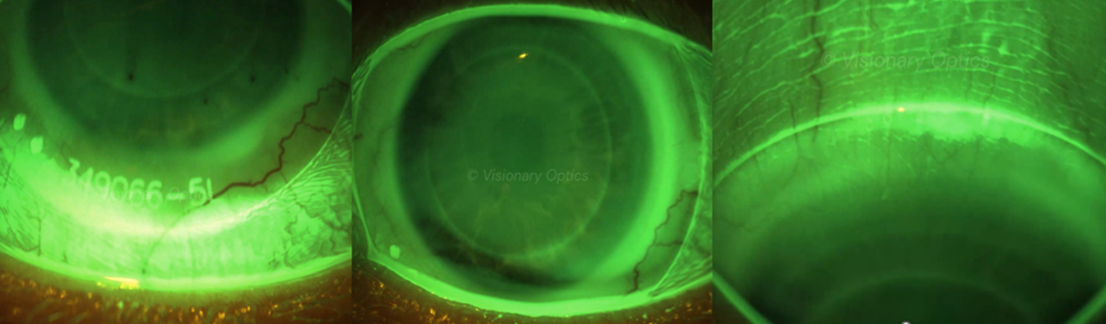 Taming Toric Haptics: When and How to Use Toric Peripheral Curves ...