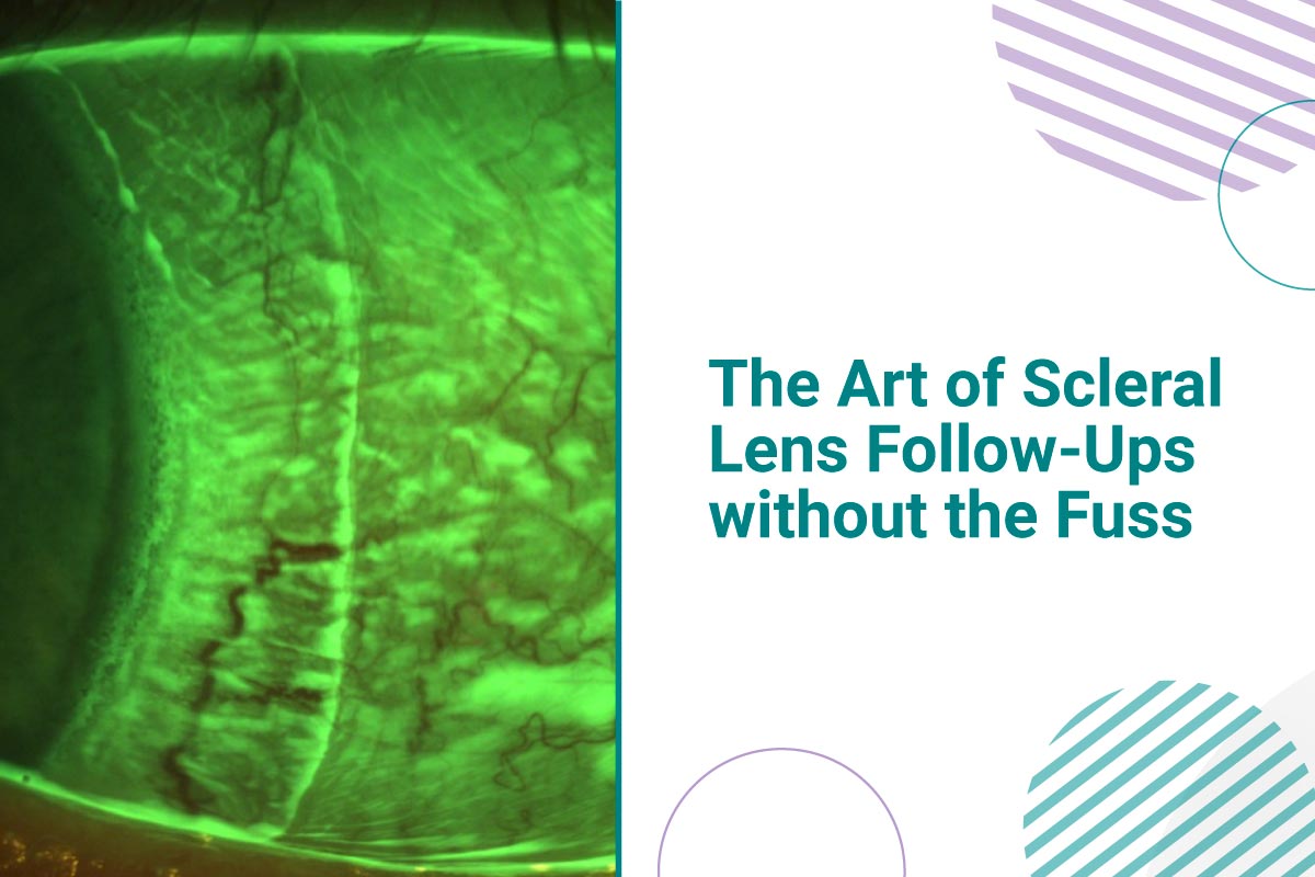 The Art of Scleral Lens Follow-Ups without the Fuss - Visionary Optics